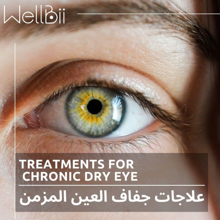 TREATMENTS FOR CHRONIC DRY EYE - Wellbii Online
